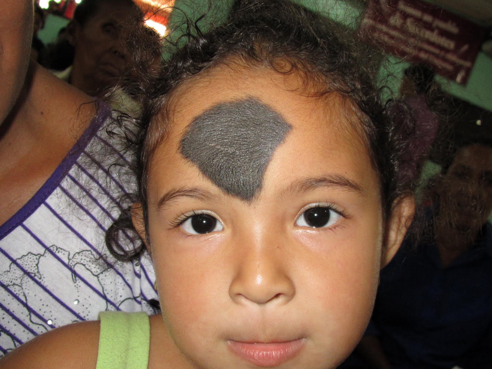 COLUMBUS MEDICAL MISSION TEAM: Cleft, forehead