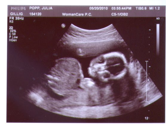 Our baby step by step!!: 20 Week Scan