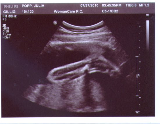 Our baby step by step!!: 30 Week Scan