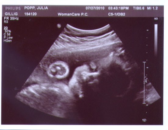 Our baby step by step!!: 30 Week Scan