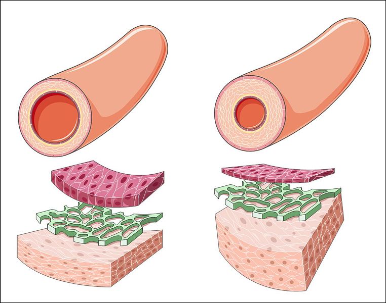 HIPERTENSION: HIPERTENSION PORTAL