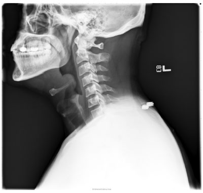 Cool X Ray Pictures