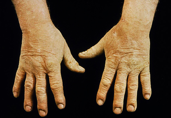 ELI5: Why do weathered hands look the way they do? : r/explainlikeimfive