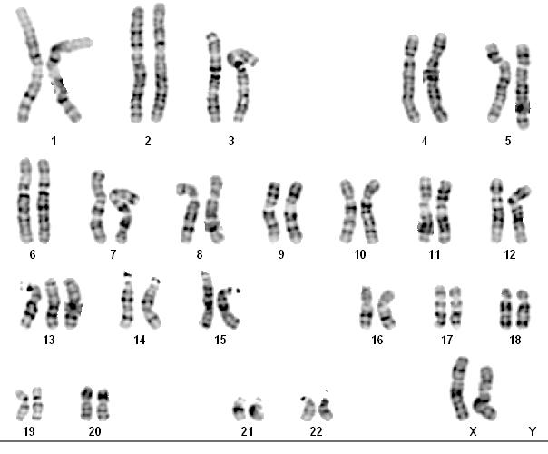Curiozitati medicale