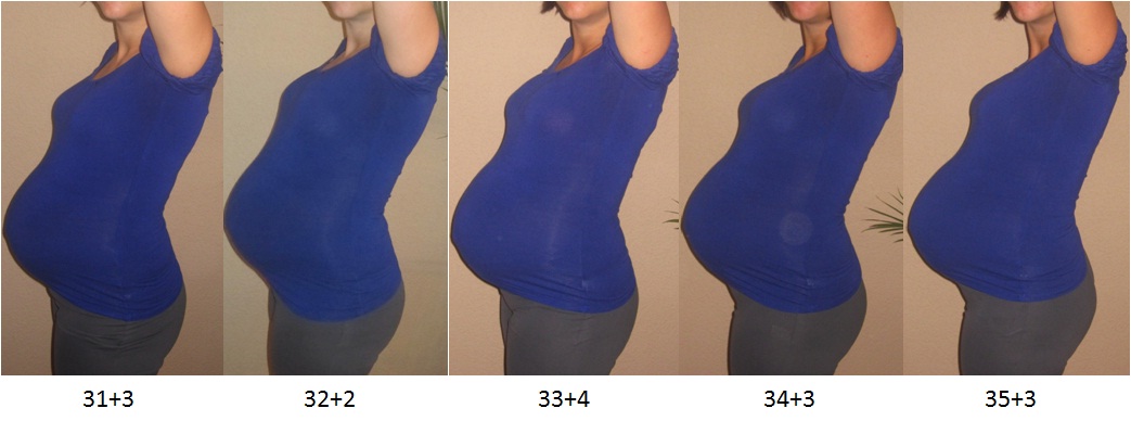 Isn Ding wa??: Bauchbild 36. SSW