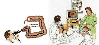 Love Your Colon: Do Colon Cleansing