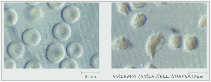 BIOLOGI GONZAGA: GENETIKA MANUSIA