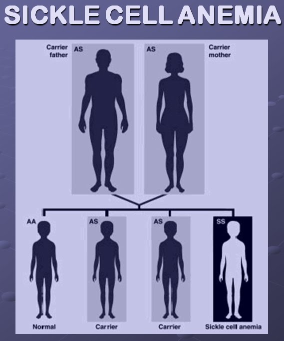 BIOLOGI GONZAGA: SICKLEMIA