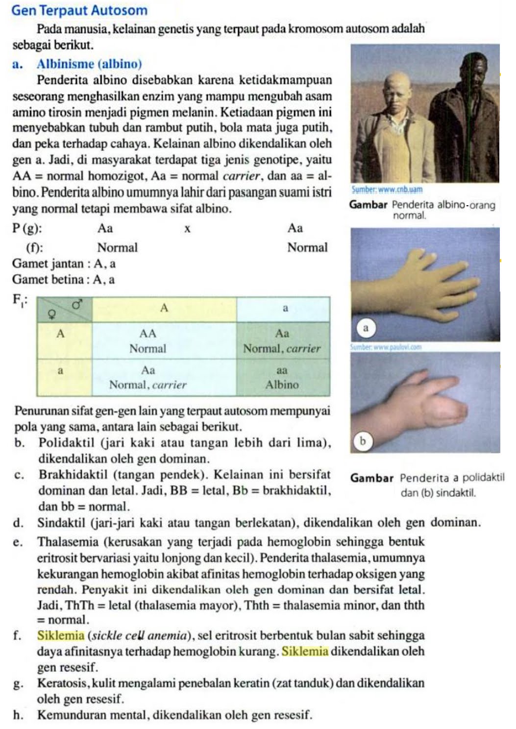 BIOLOGI GONZAGA: SICKLEMIA