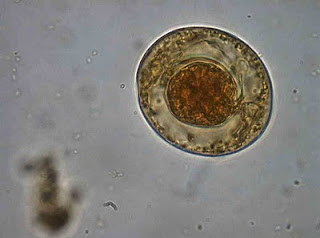 ENFERMEDADES DEL APARATO DIGESTIVO: ARTÍCULO SOBRE PARÁSITOS ...