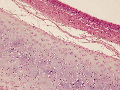 Histologia dos Sistemas: Traquéia