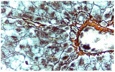Histologia dos Tecidos: Tecido conjuntivo reticular