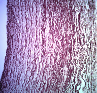 Morfologia: Artéria elástica