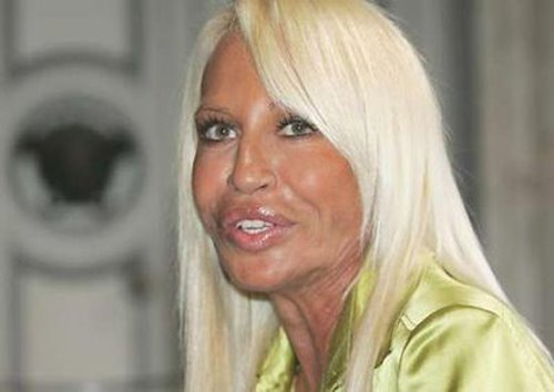 Why Oh Why?: Face Lift Friday: Donatella Versace (Age 53)
