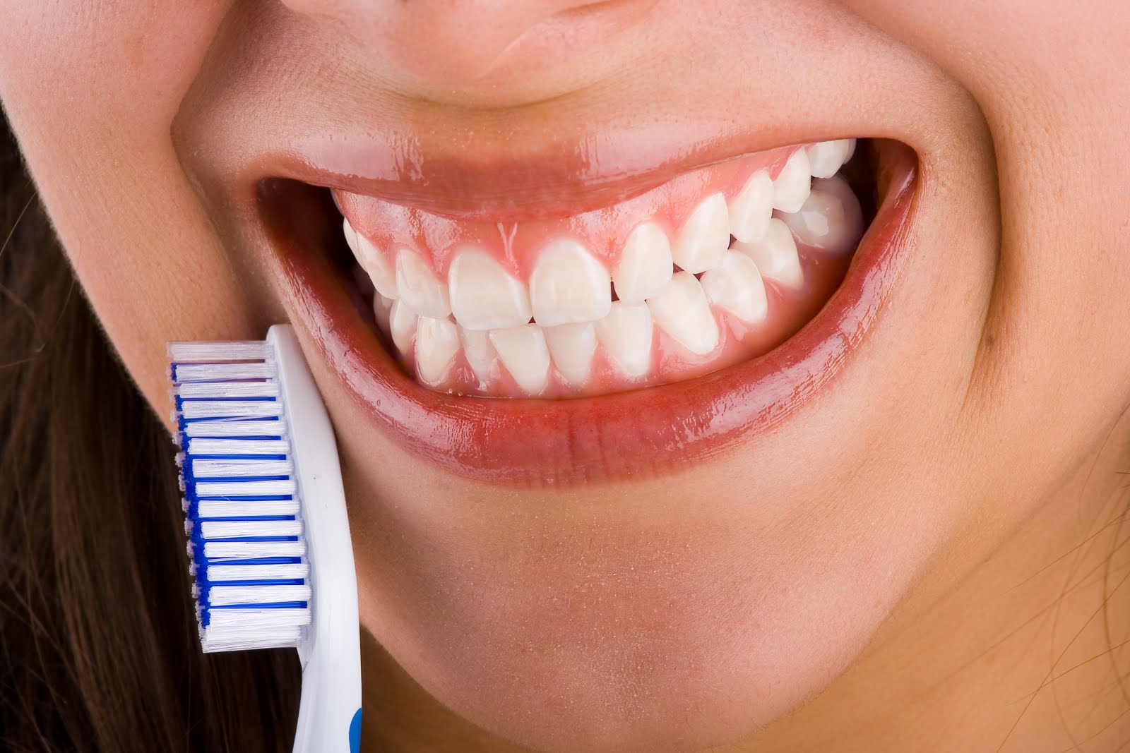 Dental Perfect: ¿Qué es la gingivitis?