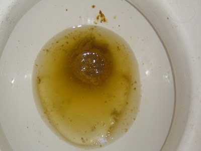 The Poop Log: December 8th, a return to poopdom