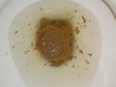 The Poop Log: post-airplane depressor poo