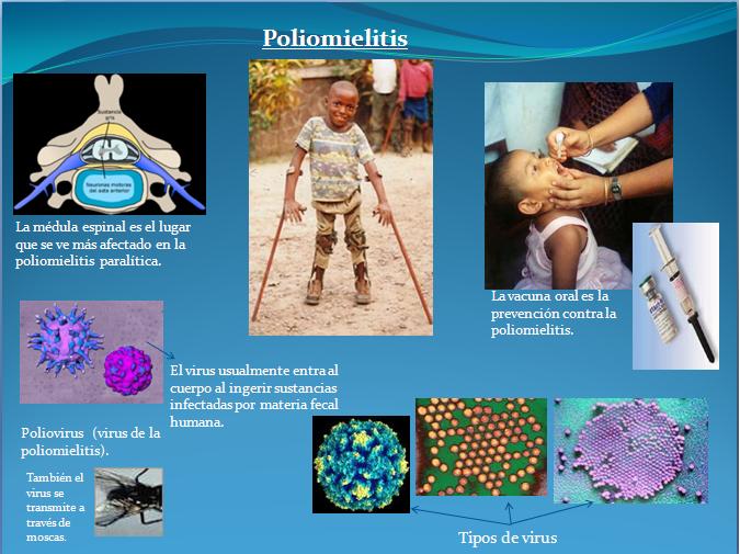 Theme 22. Picornaviruses. Laboratory diagnosis of enteroviruses disease ...