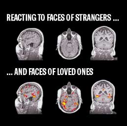 CEP 452 Blog: Asperger's...So Intriguing