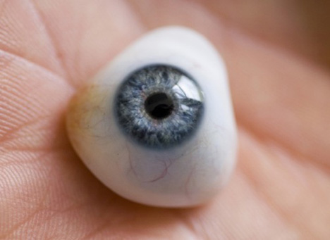 Ocularist and Artificial Eyes in India: Artificial Eye