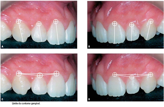 OdontoBlogger: Parâmetros Estéticos do Sorriso