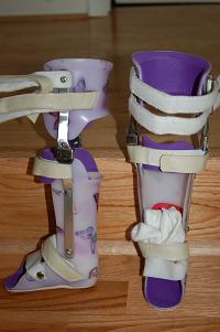 Lonnie's Blog: Various Types Of Orthopedic Leg Braces
