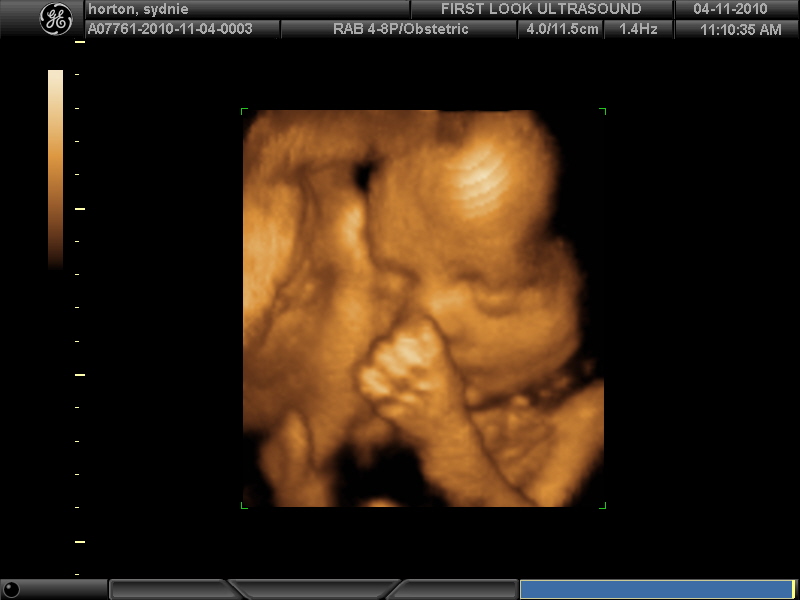 The Horton Family Blog: Ultrasounds