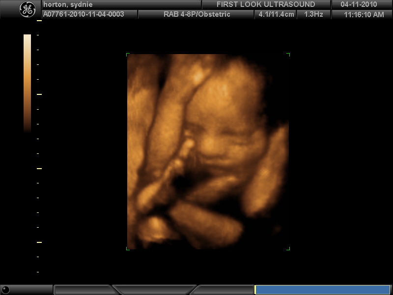 The Horton Family Blog: Ultrasounds