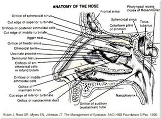Kanker Nasofaring: Karsinoma nasofaring