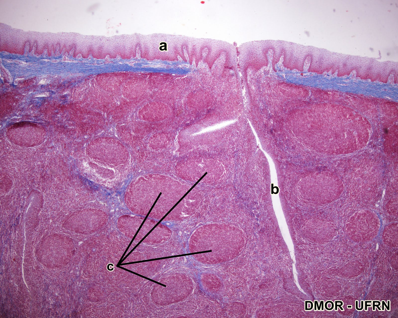 Ciências Morfológicas - UFRN: Órgãos Linfóides