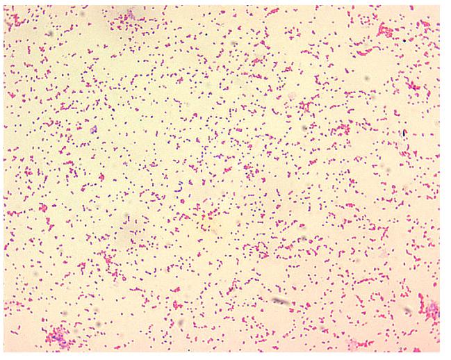 H Panji Irawan: 11/26/09