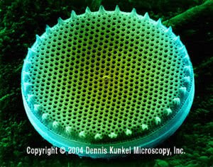 CHRYSOPHYTA ~ Keranjang Artikel