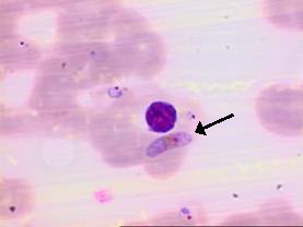 Parasitologia: Esporozoários - Filo Apicomplexa