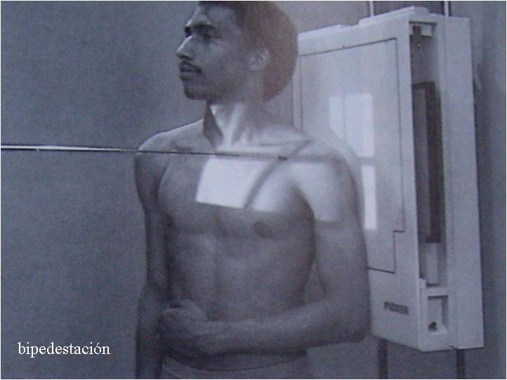 Rayos-5 ;p: ARTICULACION DEL HOMBRO PROYECCION OBLICUA AP(CAVIDAD ...
