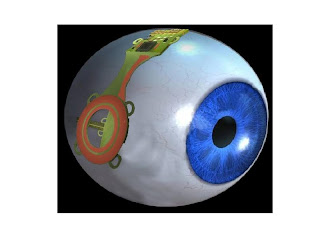 Amazing Scientific Facts: What is a bionic eye?