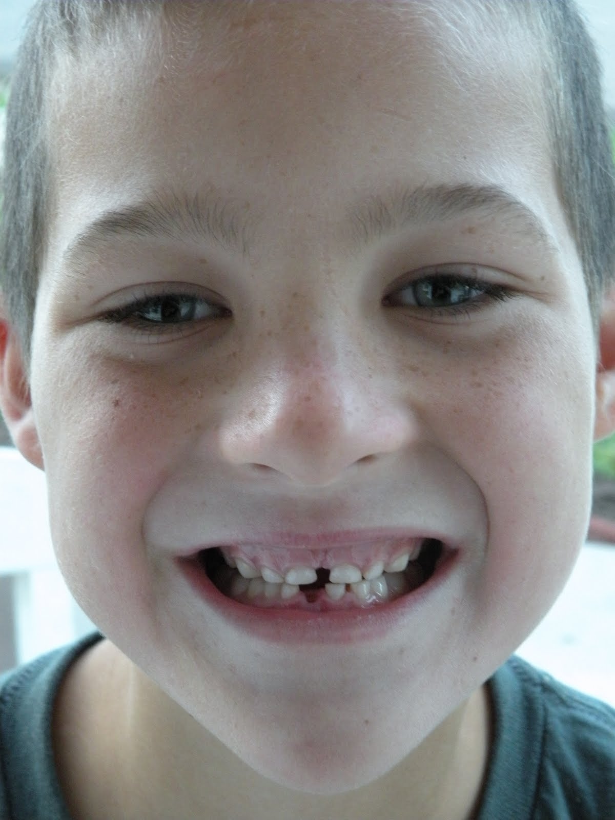 Colorado Gropps: Cole's first tooth loss