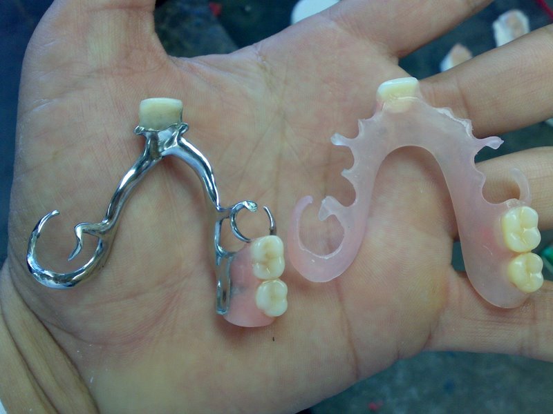 Dra Julli Ana - Cirurgiã Dentista!: O que são Próteses Dentárias?