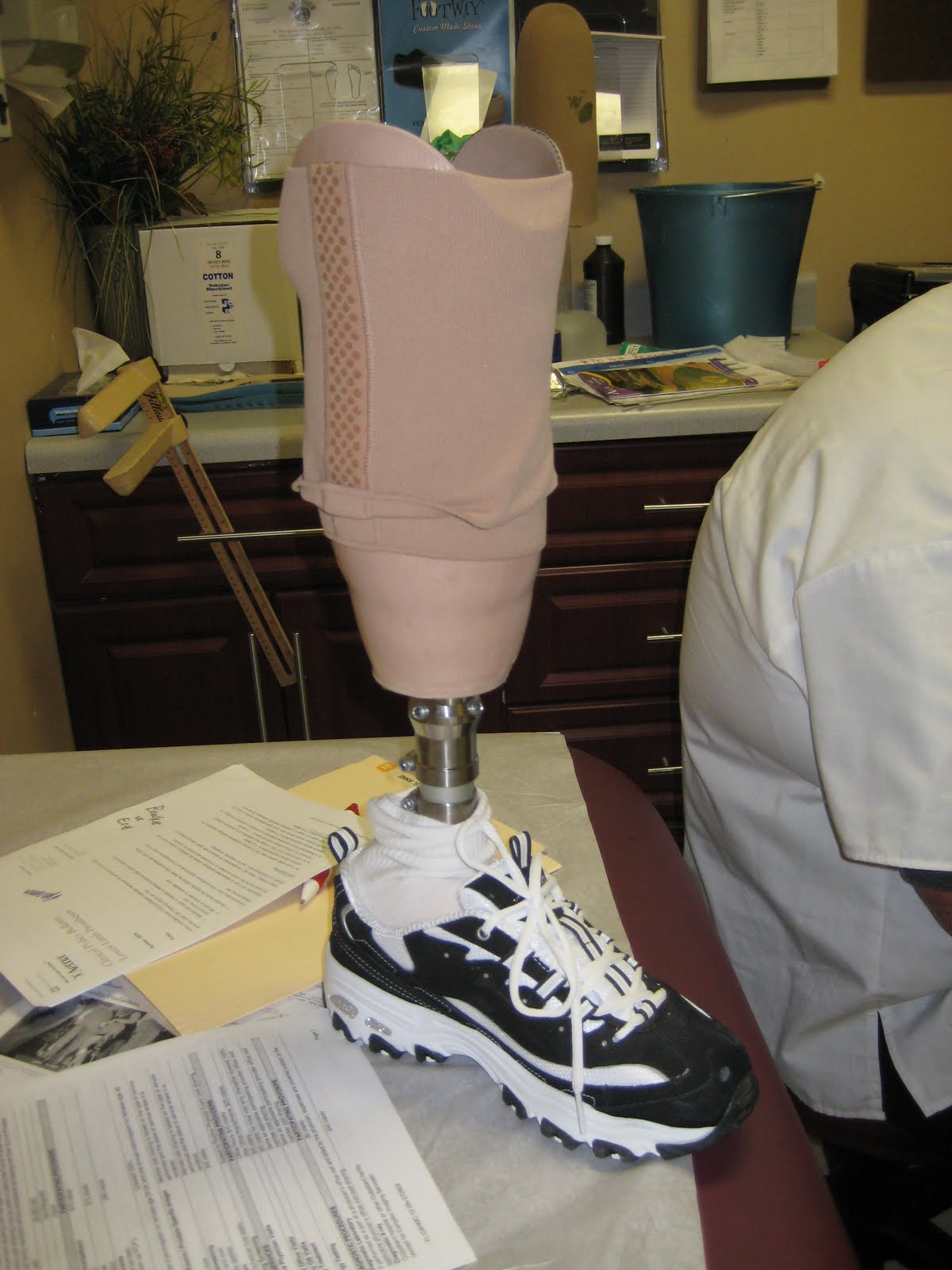 Anne's Great Fall: How we reached the decision to amputate