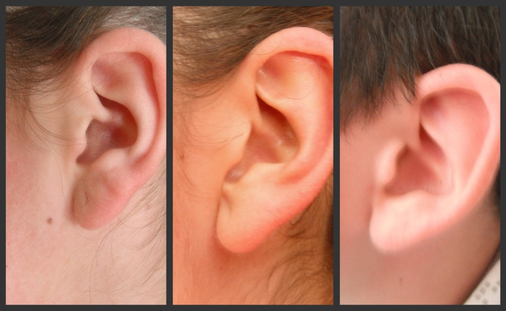 La herencia de las generaciones: LÓBULO DE LA OREJA