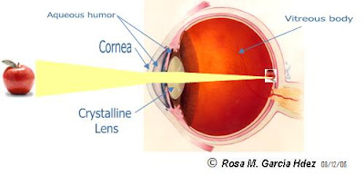 Exploring the world of vision: Refractive visual Disorders. Some ...