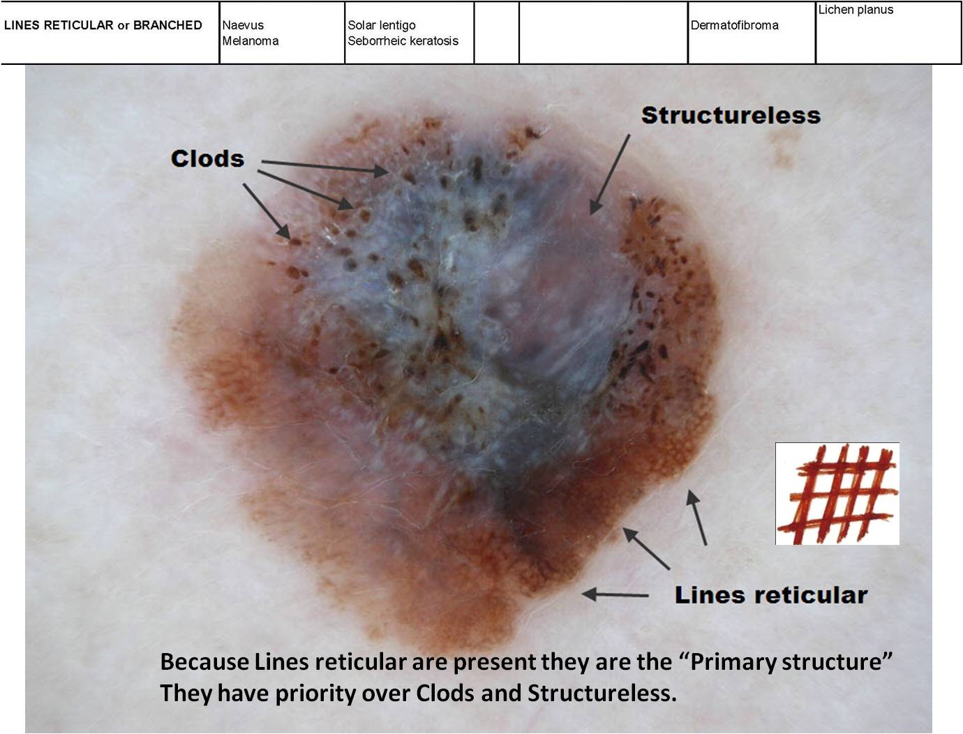 Introduction to Dermatoscopy