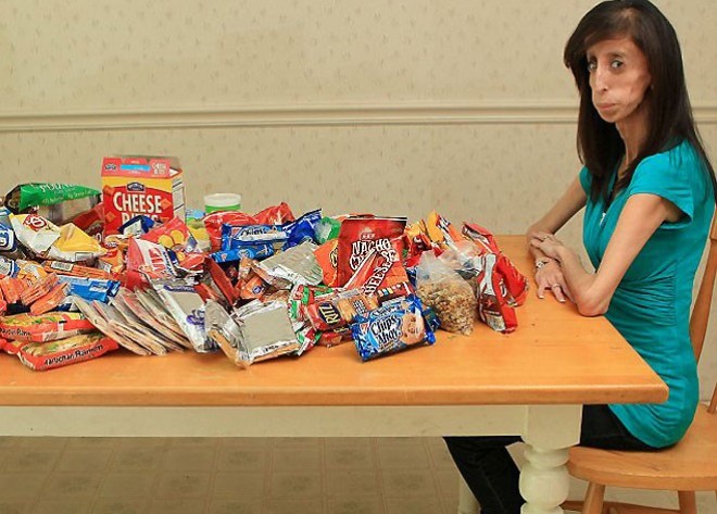 NotiFB: [Curiosidades] Chica pesa 27 kilos y come cada 15 minutos