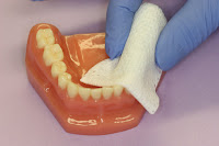 Dental Assisting Divas: How to Make a Great Provisional (AKA temporary ...