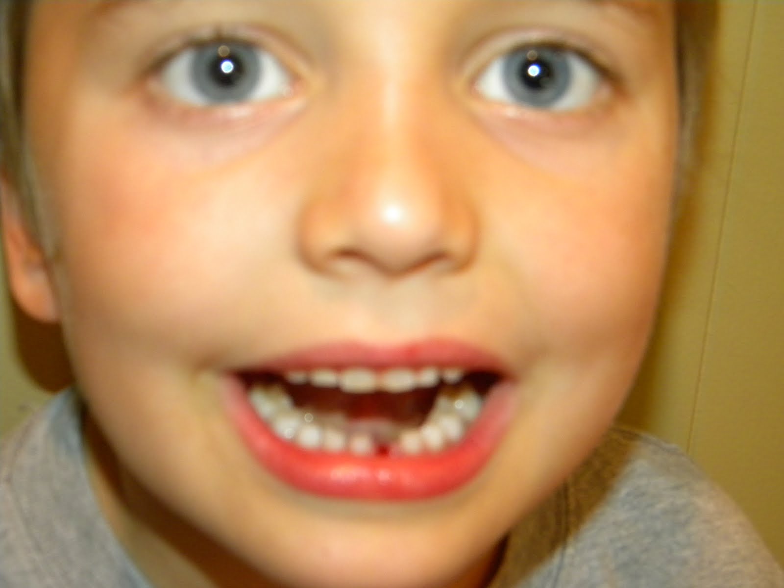 my blue eyed boys: Teeth