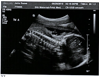 Reese Adventures: Week 25 Ultrasounds