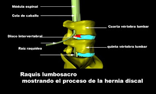 anatomia aplicada: plexo lumbo sacro