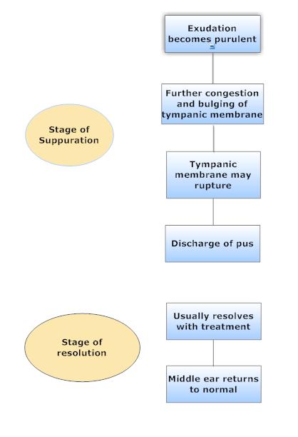 Medicine...Life: Acute Otitis Media: Which is the most important sign ...