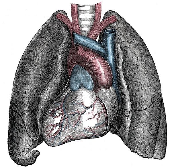 Dextrocardia - Medpedia Health