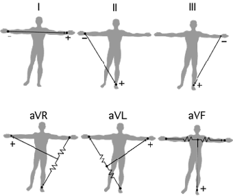 The Electrocardiogram - Part II | Paramedicine 101
