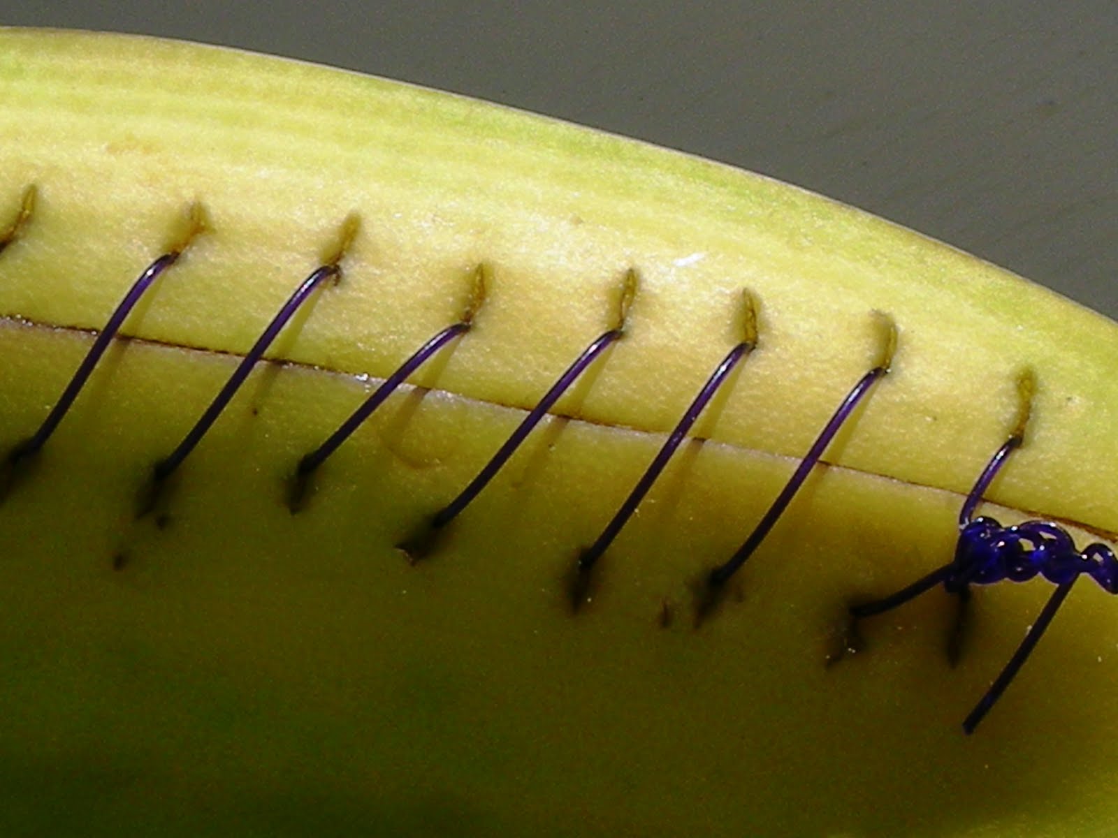 proCRAFTinatingPA: Medical Mystery Mondays- Stitches